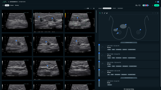 Ultrasound Assessment – See-Mode Breast & Thyroid